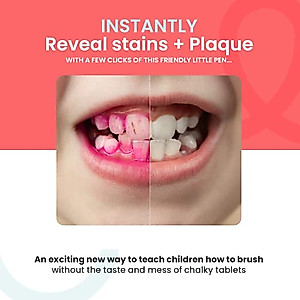 Plaque Disclosing Gel Pens for Teeth, 150 Uses, Dental Disclosing Tablet Gel for Kids & Adults - Shows Plaque, Helps Teach Kids Teeth Brushing Habits for Clean Teeth - by Idyll
