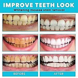 Teeth Mouthwash Foam - Teeth Calculus Removal, Teeth Whitening Mousse Foam Refreshing Breath Deep Cleaning Toothpaste, Eliminating Bad Breath, Preventing and Healing Caries (3pc)