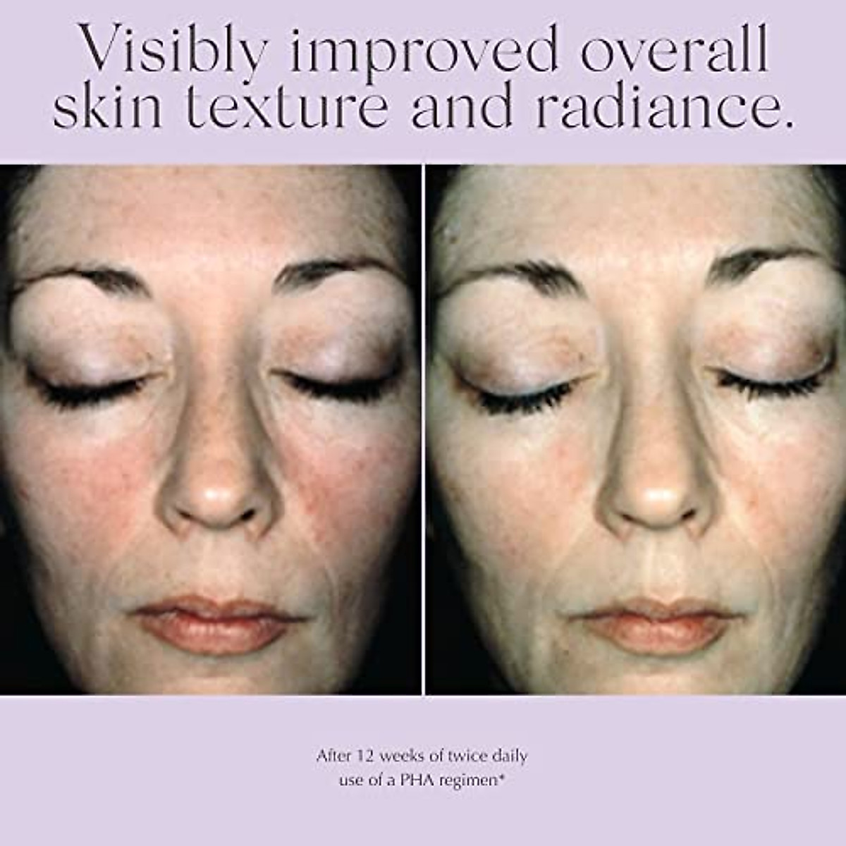 EXUVIANCE Overnight Transformation Complex Hydrating Night Cream with Hyaluronic Acid, Non-Comedogenic 50 g.