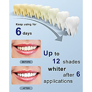 MySmile Teeth Whitening Kit with LED Light, 3 Non-Sensitive Teeth Whitening Gel and Tray, Deluxe 10 Min Fast-Result Carbamide Peroxide Teeth Whitener, Help Remove Teeth Stain from Coffee