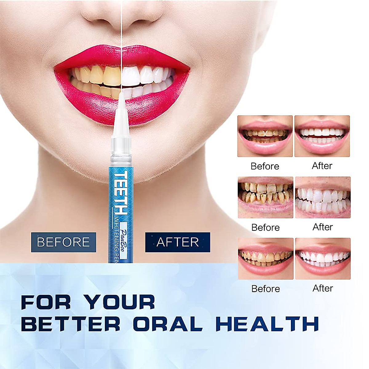 Teeth Whitening Pen, Use Twice a Day Up to 1-6 Shade Whiter in 1-2 Weeks, 4 No Sensitivity Pens, 70+ Whitening Treatments, Effective, Pain Free and Enamel Safe, Easy to Use at Home Travel, Flavourless