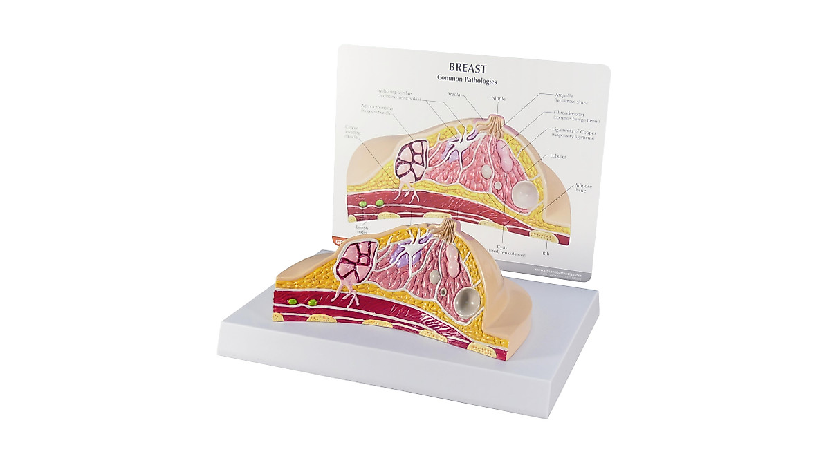 Breast Cross-Section Model | Accurate Breast Anatomy for Education