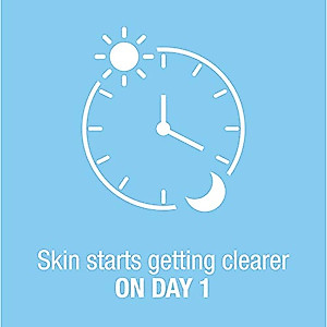 Neutrogena On-The-Spot Acne Spot Treatment with 2.5% Benzoyl Peroxide Acne Treatment Medicine to Treat Face Acne, Gentle Benzoyl Peroxide Pimple Gel for Acne Prone Skin,.75 oz (Pack of 6)