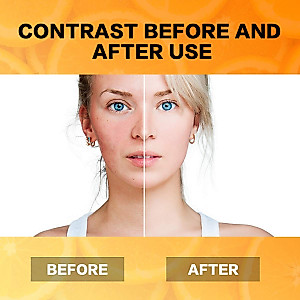 Vitamin C Serum for Face with Hyaluronic Acid to Rejuvenate Face And skin Best Serum for Anti Aging with Natural Ingredients Dark Circles Anti Wrinkl Fine Lines and Sun Damage Corrector