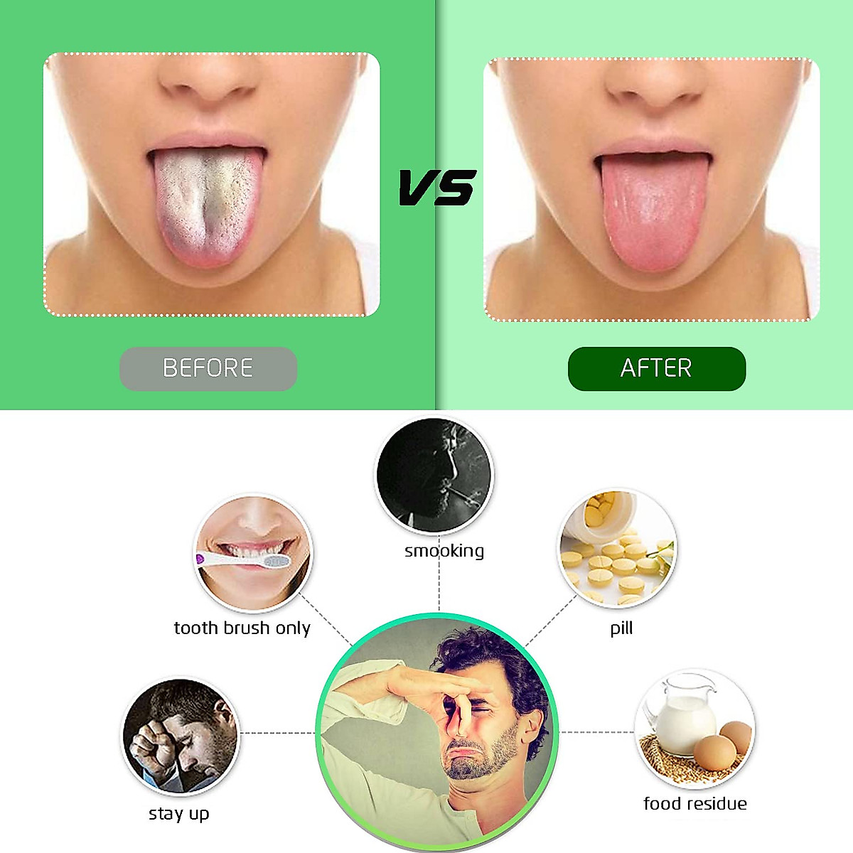 New Tongue Scraper, Premium Tongue Cleaner, Keep Oral Hygiene, Metal Tongue Scrapers, BPA Free, Medical Grade Stainless Steel, For Adults Kids, Bad Breath Treatment Tools