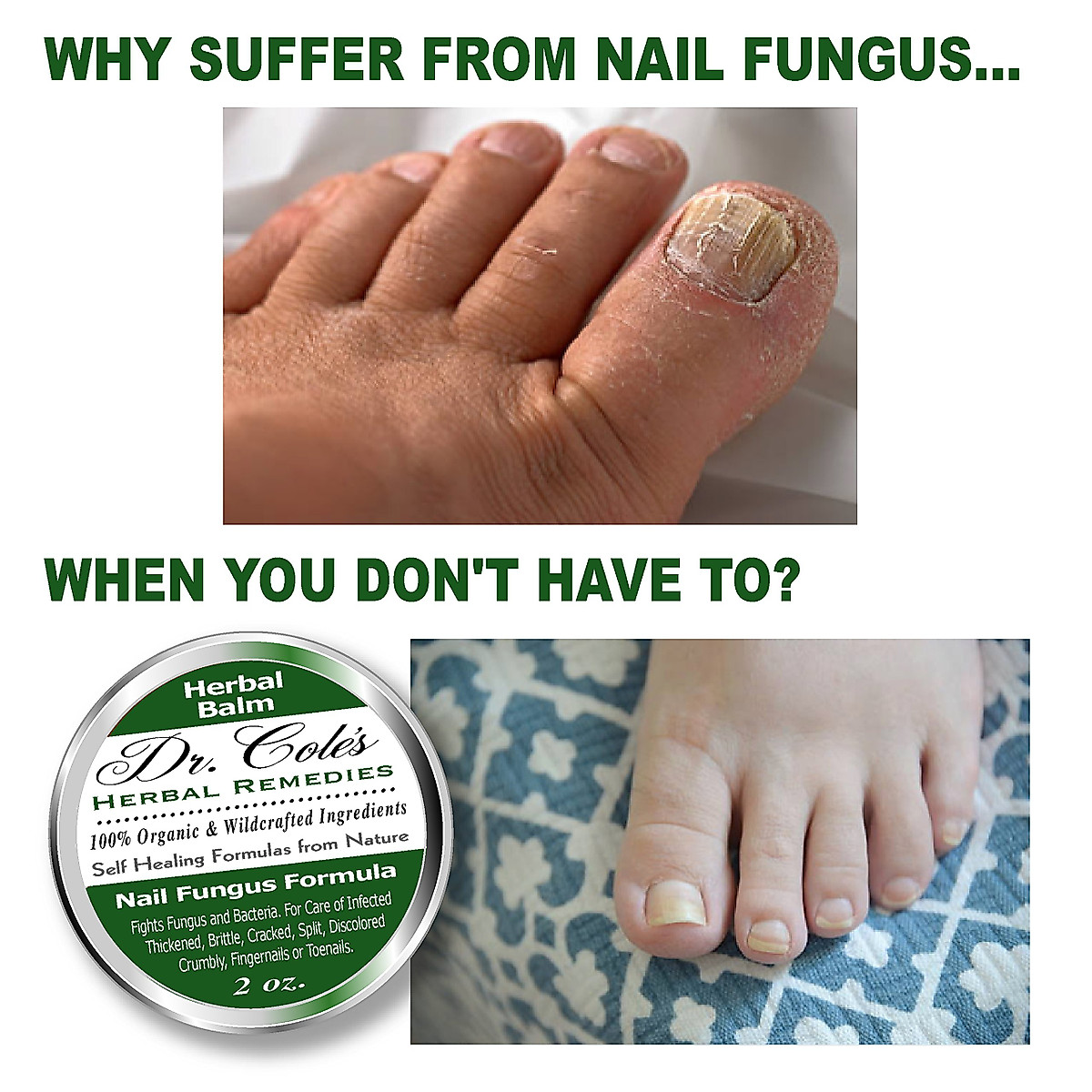 Dr. Cole’s Organic Herbal Nail Fungus Balm - May Assist with Repairing Thick, Cracked or Flakey Fingernails and Toenails