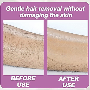 SEYNAR Crystal Hair Eraser, Painless Crystal Hair Removal Tool, Quick and Easy Exfoliation, Reusable, Mini Magic Crystal Hair Remover for Leg Arm Back (pink)