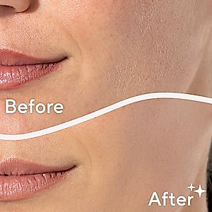 Finishing Touch Flawless Dermaplane Facial Exfoliator and Hair Remover, Facial Hair Removal for Women, 6 Count