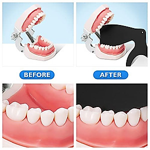 Annhua Dental Contraster Intraoral Photographic, 6 PCS Dental Photo Contrast Kit Palatal Intraoral Photography Kit Black Background Board for Dental Clinic, Lab - Autoclavable