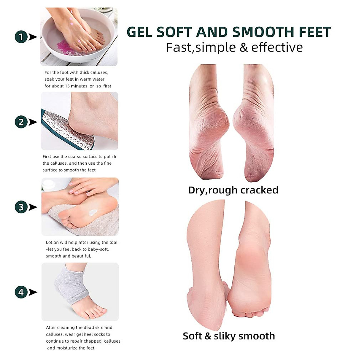 Foot File and Spa Socks Set, Foot Care Pedicure Stainless Steel File, Gel Lined Toeless Spa Socks, Moisturizing Heel Socks (Green+Grey)