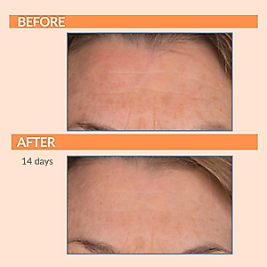 Serious Skincare Serious-C3 Plasma Vitamin C Day Trio - C Cream Daytime Moisturizer SPF 30 2 oz, Vitamin C Serum Skin Conditioner 1 oz. and C-Eye Treatment 0.5 oz.- For Smooth Radiant Skin