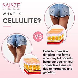 SAISZE Anti Cellulite Body Slimming Cream 8.8oz & Massager and Remover Brush Mitt (Slimming Cream + Massager)