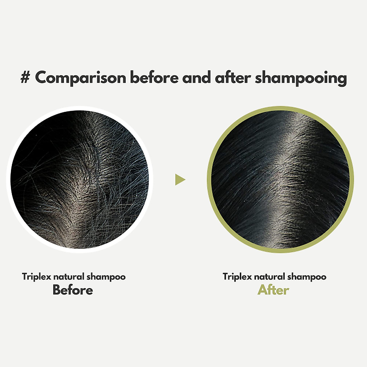 LA'DOR TripleX 3 Deep Cleansing Shampoo for Dry Itchy Sensitive Scalp Dandruff w/Tea Tree Lemon Lavender Sulfate-free Korean Hair Care 10 Fl Oz