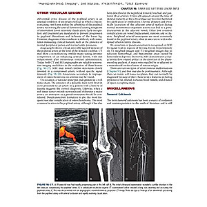 Musculoskeletal Imaging: Expert Radiology Series