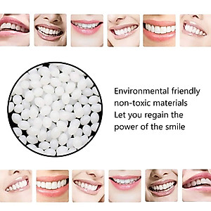 XBKPLO Multi-Functional Temporary Tooth Repair Kit Moldable Thermal Fitting Beads for Snap On Instant and Confident Smile Denture Adhesive Fake Teeth Cosmetic Braces Veneer (15g)