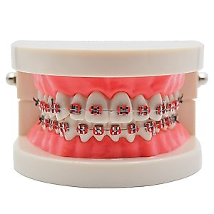 Standard Tooth Teaching Mallocclusion Orthodontic Teeth Model with Brackets Archwire Buccal Tube Tool