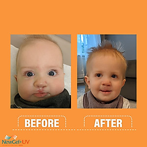 NewGel Plus UV by MyNewGel Advanced Silicone Scar Gel for OLD and NEW Scars with SPF30 Mineral non-chemical Sunscreen, Ideal for Protecting Scars from harmful ultraviolet rays, 15g (0.5 oz)