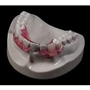 "Nesbit bridge" , Flipper Uppler and Lower Set of Affordability Flexible Valplast Customized Partial Denture (Pink, Valplast)