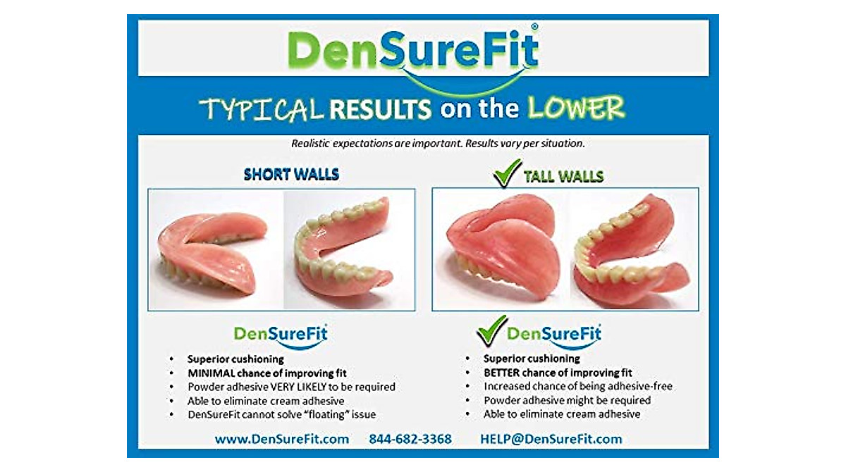 DenSureFit Denture Reline Kit for Ultimate Comfort