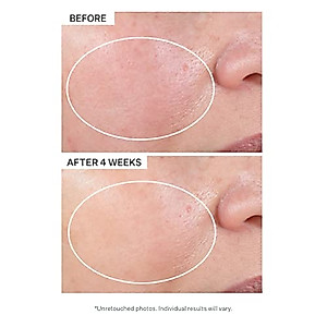 StriVectin Advanced Retinol Intensive Night Moisturizer, 1.1 Fl Oz