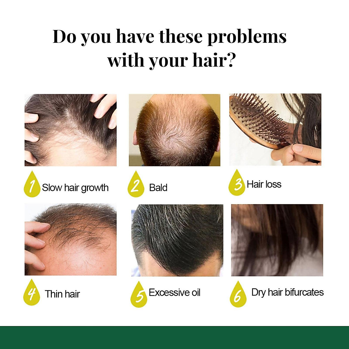 Ginger Germinal Oil, 7 Days Ginger Hair Growth Spray Serum Anti Hair Loss Products Fast Grow Prevent Hair Oil Dry Damaged Thinning Repair Care for Women & Men (50ml)