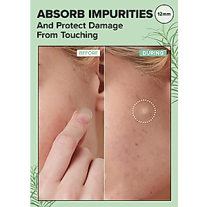 I DEW CARE Hydrocolloid Acne Pimple Patch - Timeout Blemish Original + Timeout Blemish Plus Bundle