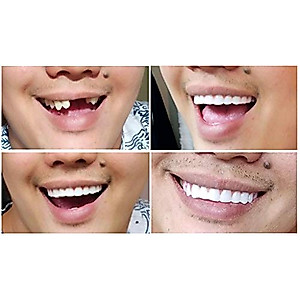 Billy Bob Instant Smile Comfort Fit Flex Cosmetic Teeth, Bright White Shade, Comfortable Upper Veneer, 1 Size Fits Most