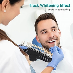 Dental Shade Guide Professional 3D R-20 Tooth Whitening Shade Chart with 20 Colors Teeth Shade Guide with Mirror