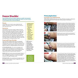 The Guide to Modern Cupping Therapy: Your Step-by-Step Source for Vacuum Therapy [Spiral-bound] Shannon Gilmartin