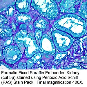 Periodic Acid Schiff (PAS) Stain Pack, 500ml