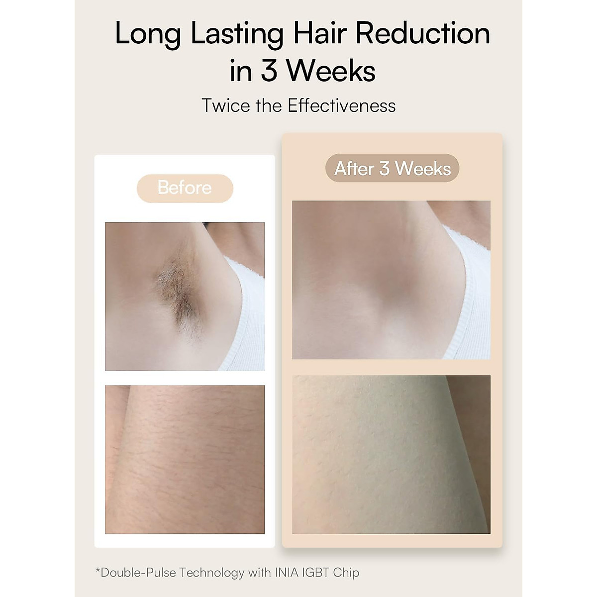 INIA Laser Hair Removal for Women and Men, IPL Hair Removal Device with Sapphire Ice-Cooling, Double Effectiveness & 5 Flashes per Second for Long-Lasting and Nearly Painless Results