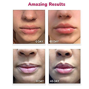 LifeCell Lip Plumping Treatment