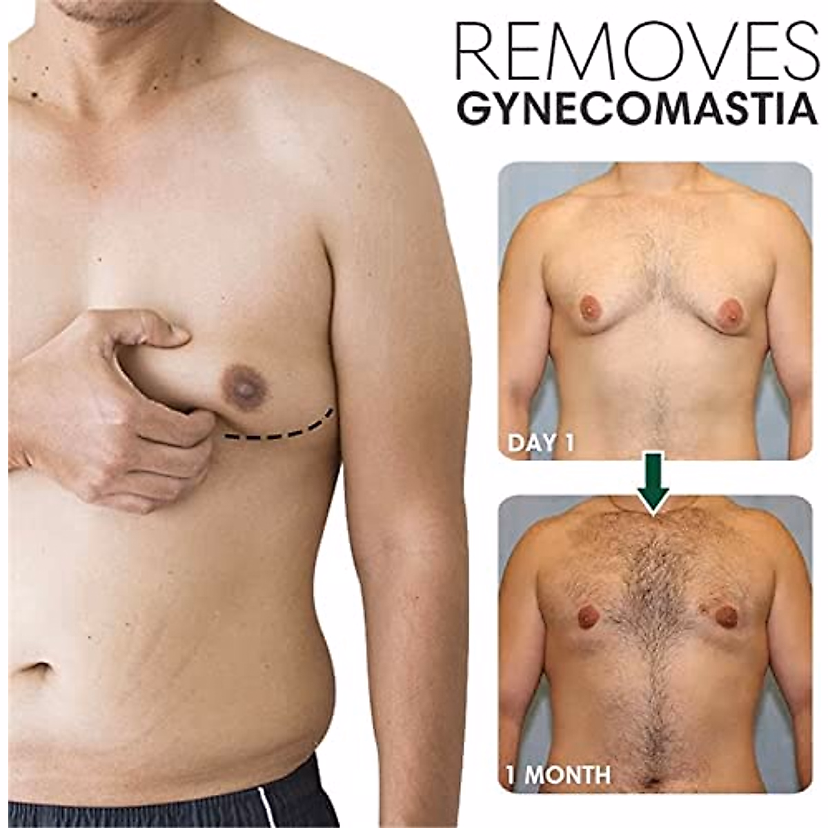 Endxedio SoliPac Gynecomastia Tightening Ginger Cream,Gynecomastia Tightening Ginger Cream,Effectively Shrinks Men Chest Tightening Ginger Cream,Effective Remove Excess Fat (3pcs)