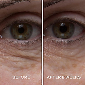 ELEMIS Peptide4 Eye Recovery Cream, Reviving Eye Cream, 0.5 Fl Oz