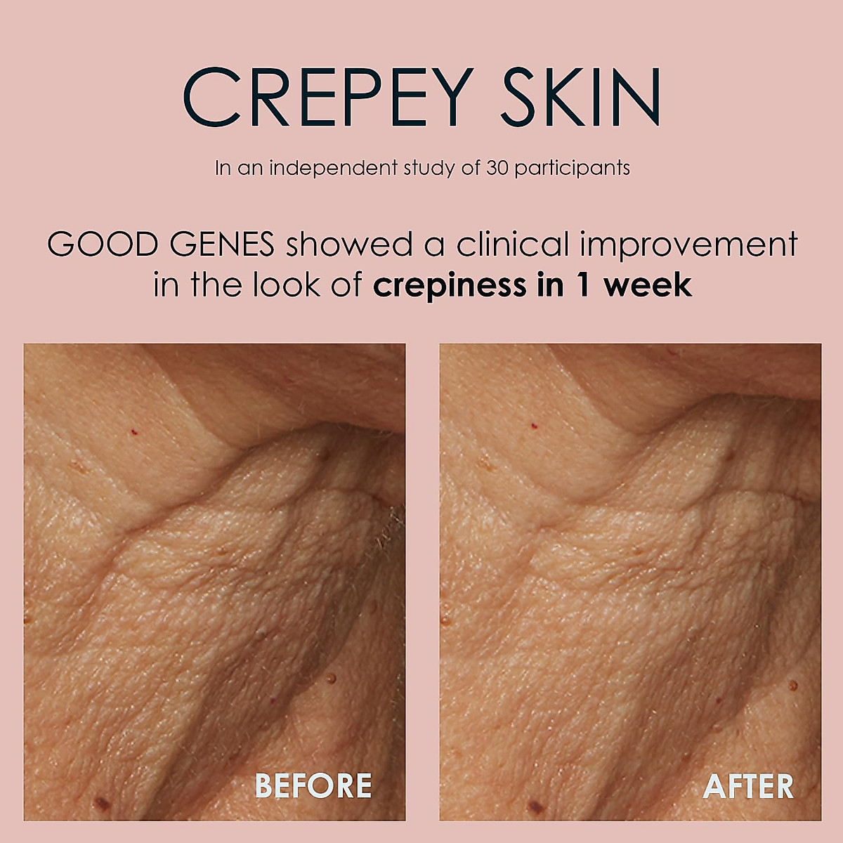 Sunday Riley Good Genes All-in-One Lactic Acid Treatment Face Serum 1.0oz