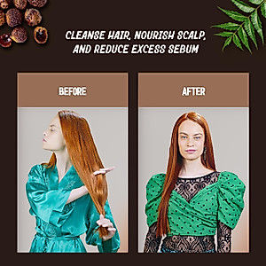 AyurVita Shampoo – Daily Nourishing Shampoo – Neem and Reetha Infused – Suitable For All Hair Types - Moisturizing, Strengthening & Lightweight Protection – Best Hair Growth Formula - 10 fl oz