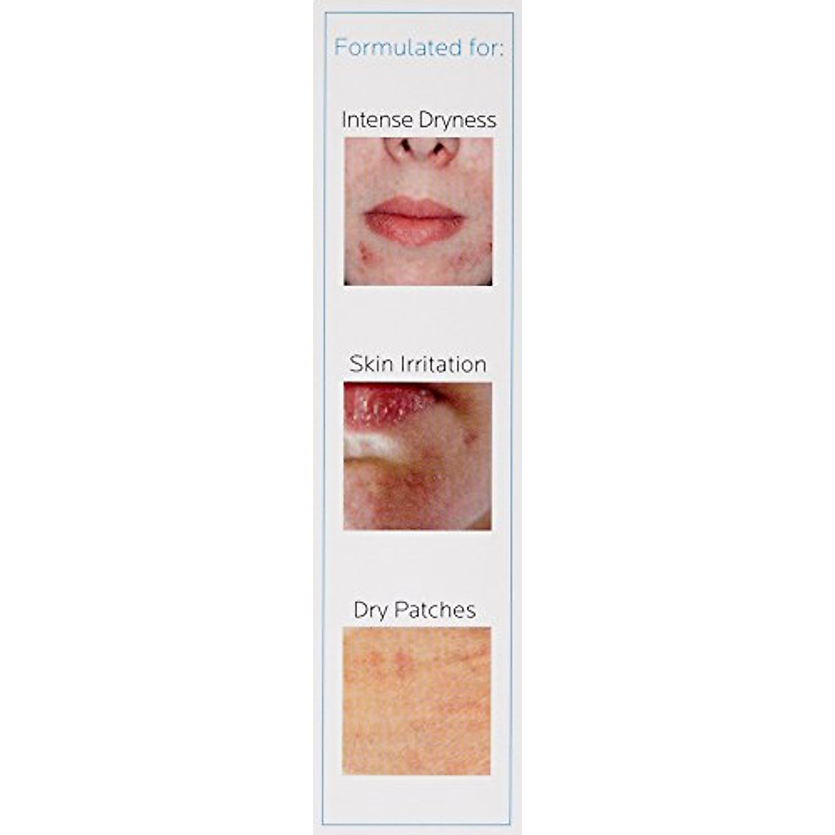 La Roche-Posay Cicaplast Baume B5 Soothing Multi-Purpose Balm, 1.35 Fl oz