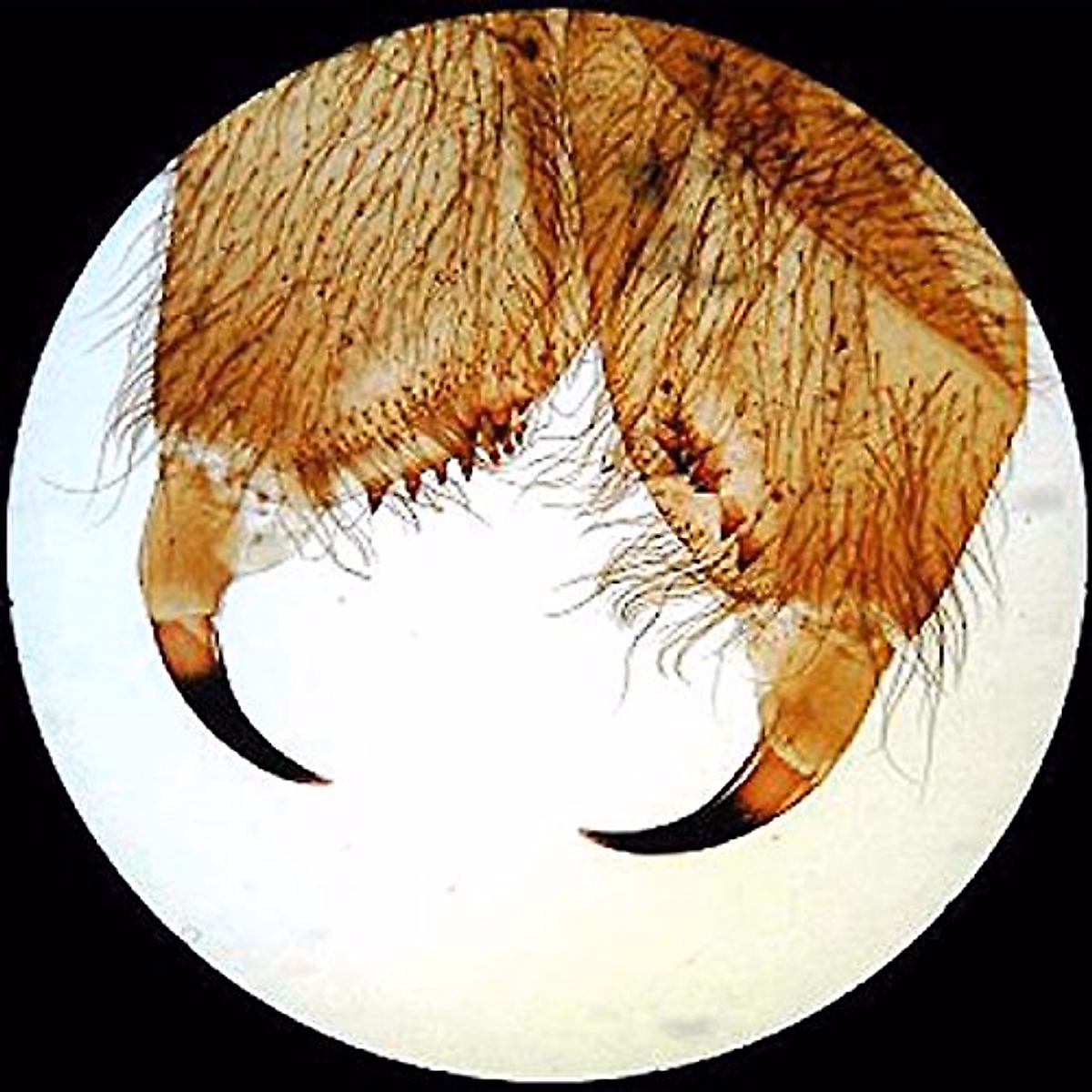 AmScope PS100D Prepared Microscope Slide Set for Basic Biological Science Education, 100 Anatomy and Botany Slides, Set D, Includes Fitted Wooden Case