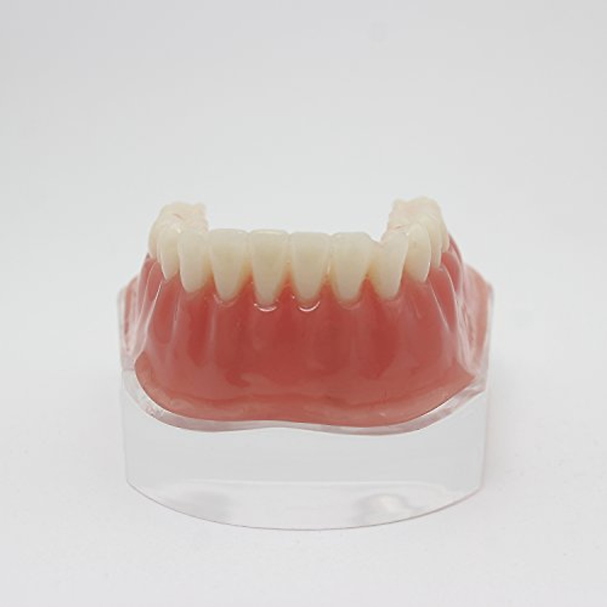 Dental Teeth Model Precision 4 Implant Overdenture Inferior Tooth Golden Color