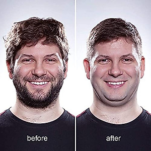 ELORES Ear and Nose Hair Trimmer for Men & Women, 4 in 1 Electric Eyebrow Trimmer Painless Nose Clippers Facial Hair Remover Waterproof with Dual Edge Blades