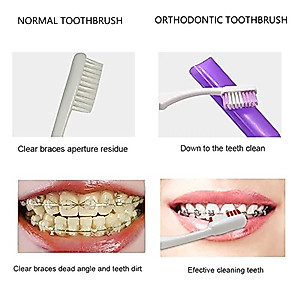 Net Bag Portable Orthodontic Care Kit Orthodontic Toothbrush Kit for Orthodontic Patient for Braces Travel Oral Care Kit Dental Travel Kit Interdental Brush Dental Wax Dental Floss (8 Pcs/Pack)-Purple