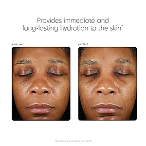 PCA SKIN Hyaluronic Acid Serum for Face, Boosts Hydration, Reduces Fine Lines & Wrinkles, Hyaluronic Acid Serum, 1 oz Pump