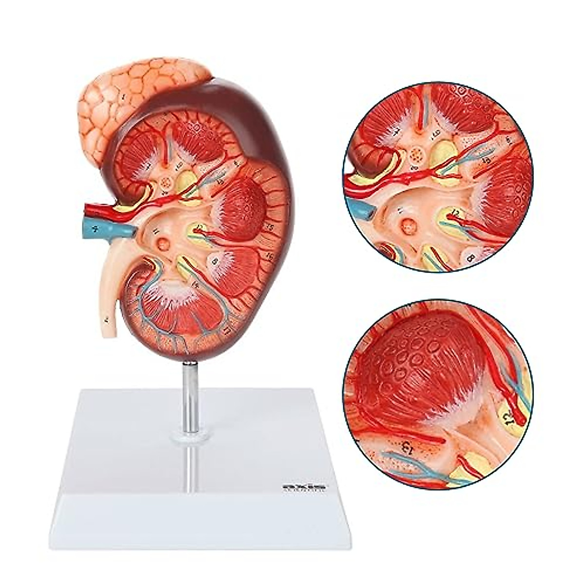 Kidney Anatomy Model with Adrenal Gland, Includes Base, Made by Axis Scientific