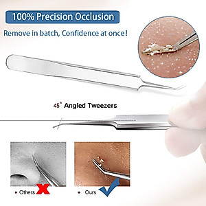 5PCS Blackhead Remover, Pimple Comedone Extractor, Whitehead Removal Tool, Acne Blemish Tools Set, Professional Blackheads Tweezers Kits