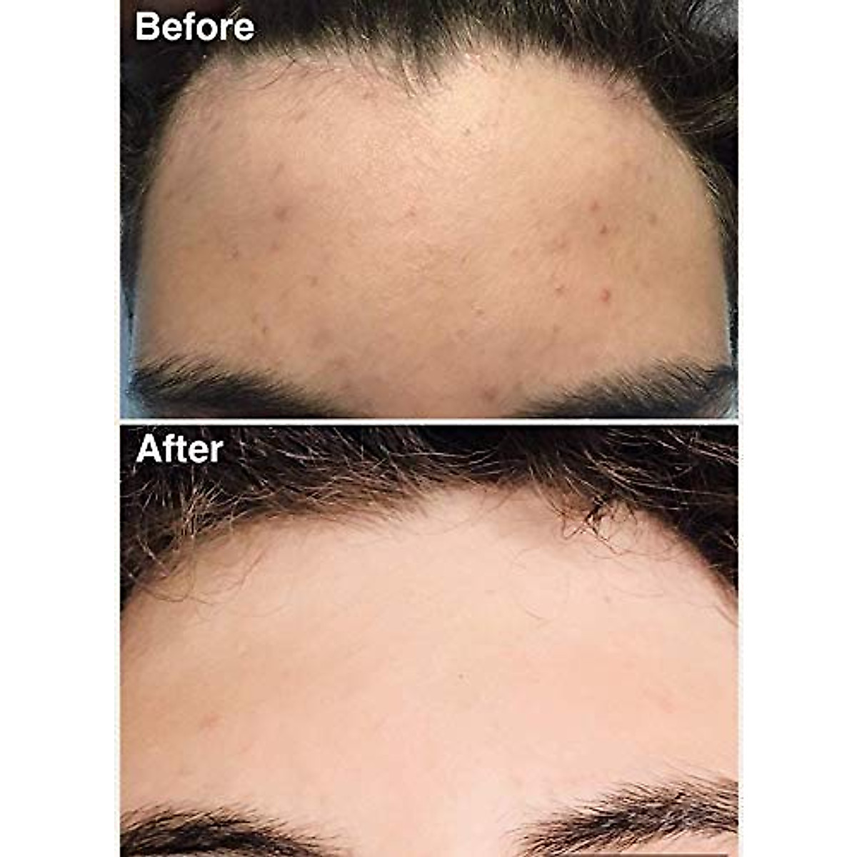 Teenology Conditioner for Teens - Avoid Forehead and Body Acne - Sulfate and Paraben Free, Noncomedogenic, Natural Botanical Extracts, Vanilla Almond - 16 oz.