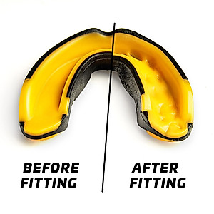Legenda Mouth Guard Sports w/Case, Professional Mouthguard for Boxing, Football, Hockey, Jiu Jitsu, Muay Thai, MMA, Wrestling and High Contact Sports, Fits Adults, Youth, Kids 11+ (Black/Yellow)