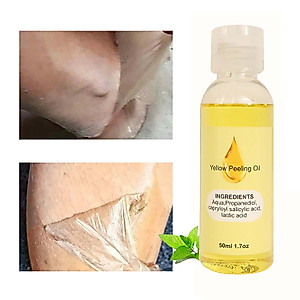 Natural Spots Whitening Yellow Peeling Oil 50ml, 1.7oz, Super Strength Yellow Peeling Oil Exfoliating for Dark Skin, Peeling Solution Bleaching Lighten Elbows Knees Hands Melanin (50ml*1pc)