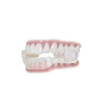 SleepRight Secure-Comfort Dental Guard to Prevent Teeth Grinding and Damage