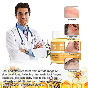 UEUEKOKO Eczema Psoriasis Manuka Relief Honey Cream, Hand Foot, Tinea Versicolor, Itchy Feet, Butt, Anal Itch, Scalp Dandruff, Bee Sting, Bites, Boil Cyst, Armpit, Adults Kids, Hidradenitis Treat