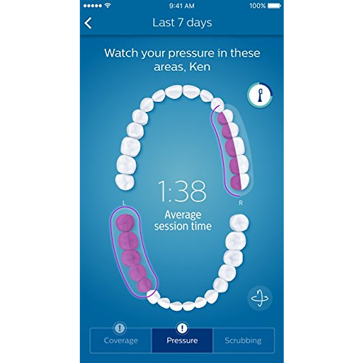 Philips Sonicare DiamondClean Smart 9500 Series Rechargeable Electric Power Toothbrush with Charging Travel Case, Complete Oral Care, Grey, Frustration Free Packaging, HX9924/37